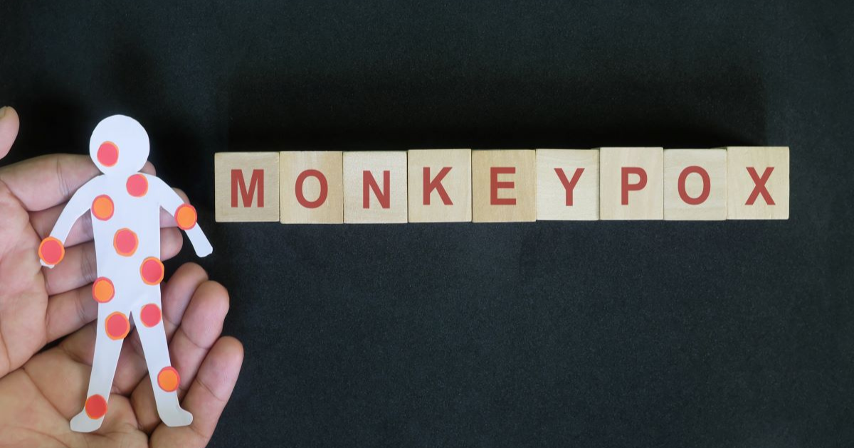 From dating to concerts, these activities can increase Monkeypox risk ...