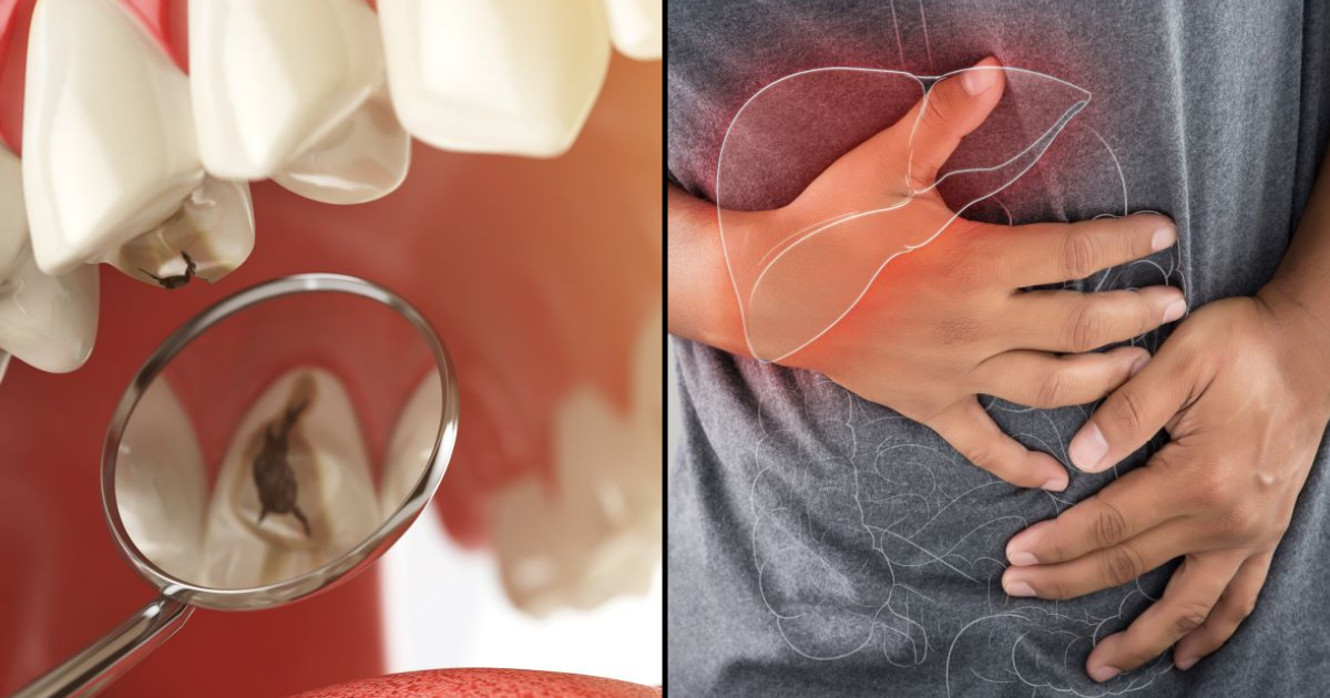 Cancer Risk Poor Oral Hygiene Raises The Risk Of Liver Cancer By 75