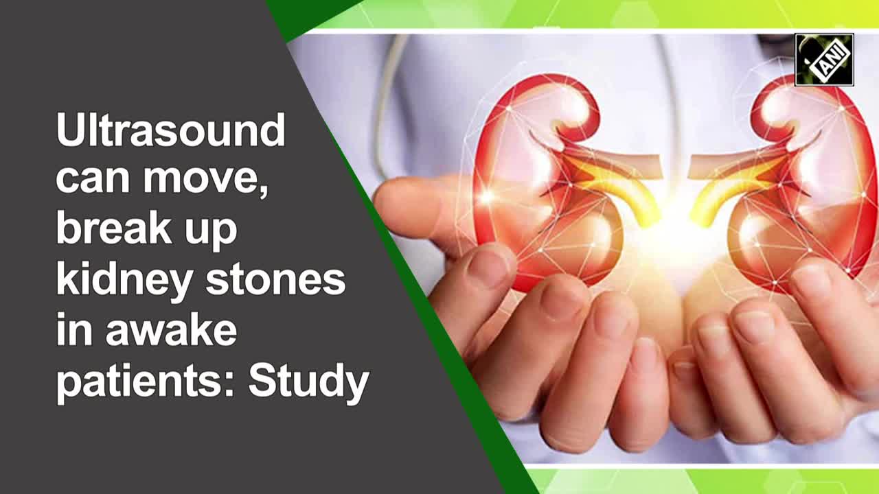Ultrasound can move, break up kidney stones in awake patients: Study