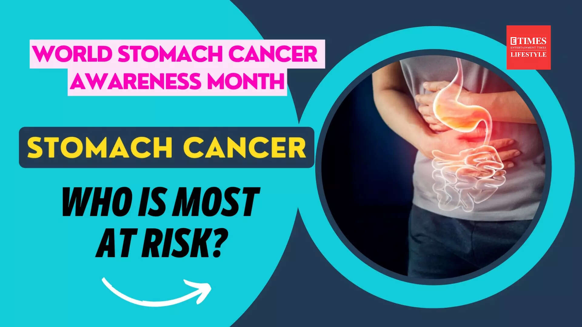 Stomach cancer: Who is most at risk?
