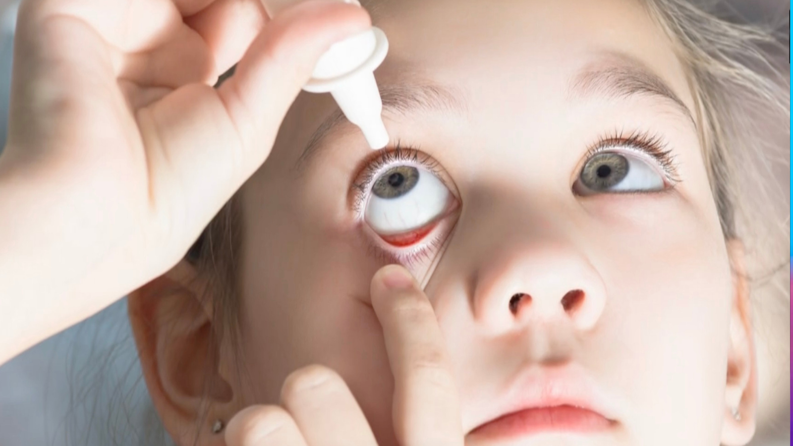 Genetics combined with many years of schooling might cause Myopia: Research