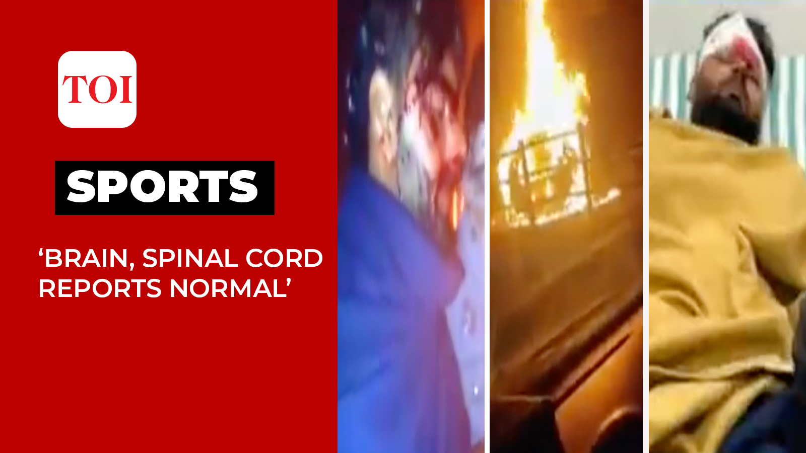 Rishabh Pant miraculously survived high-speed car crash: All you need ...