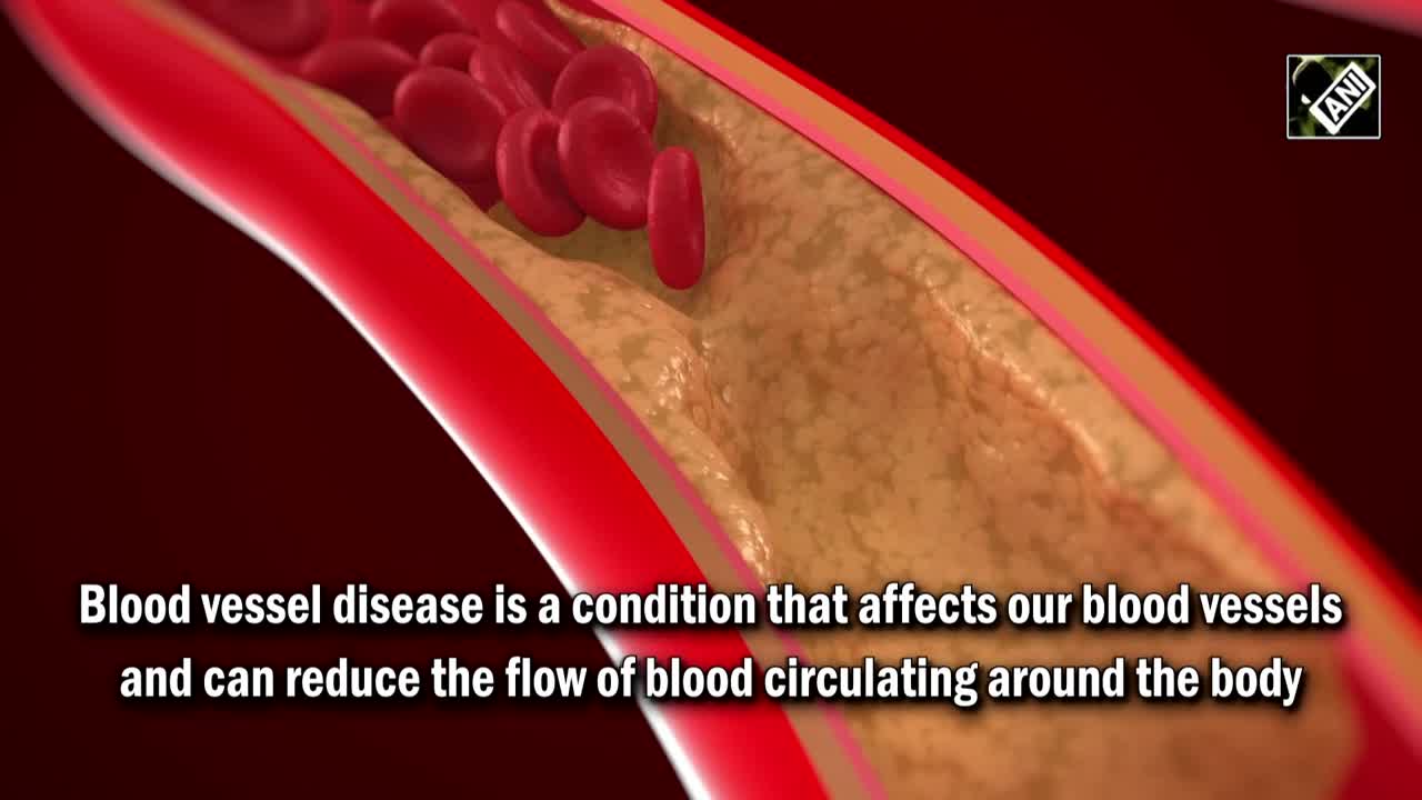 Researchers suggest green veggies good for blood vessels