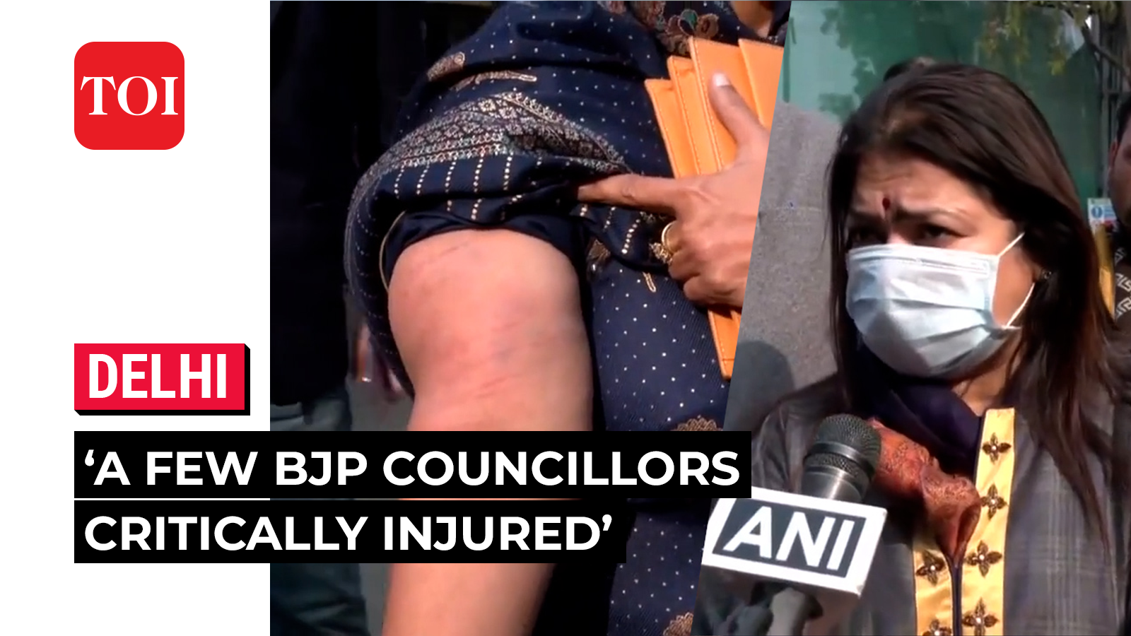 Delhi Mayor election chaos: BJP councillors injured; Union Minister Meenakshi Lekhi slams AAP's ...