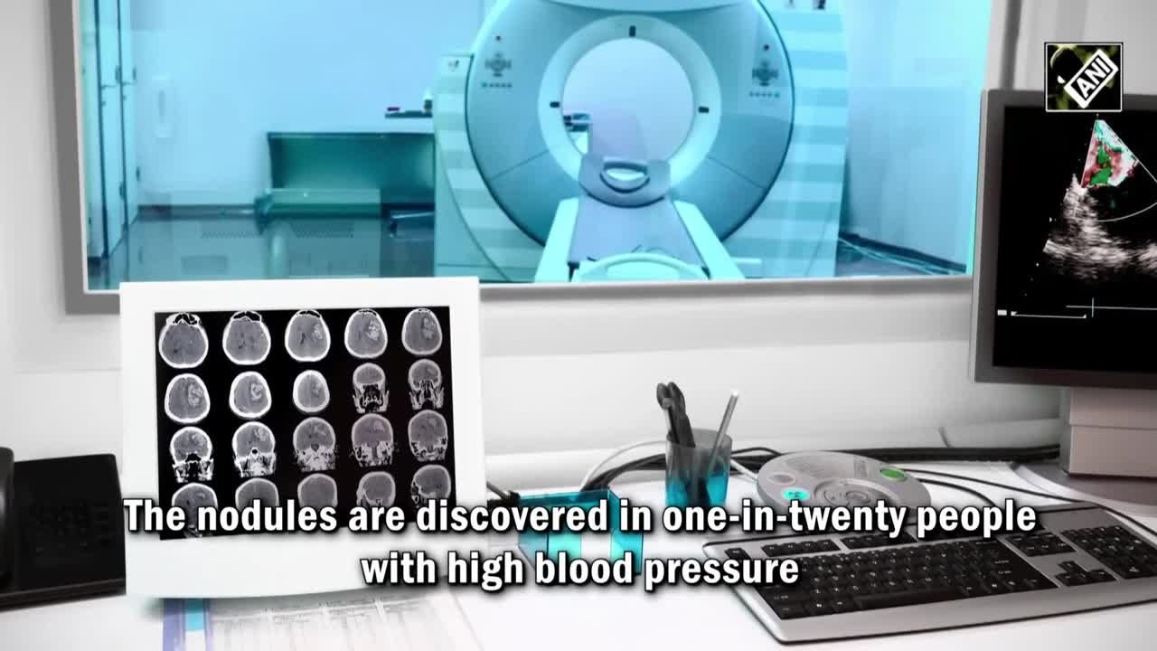 CT scan enables detection and cure of the commonest cause of high blood ...