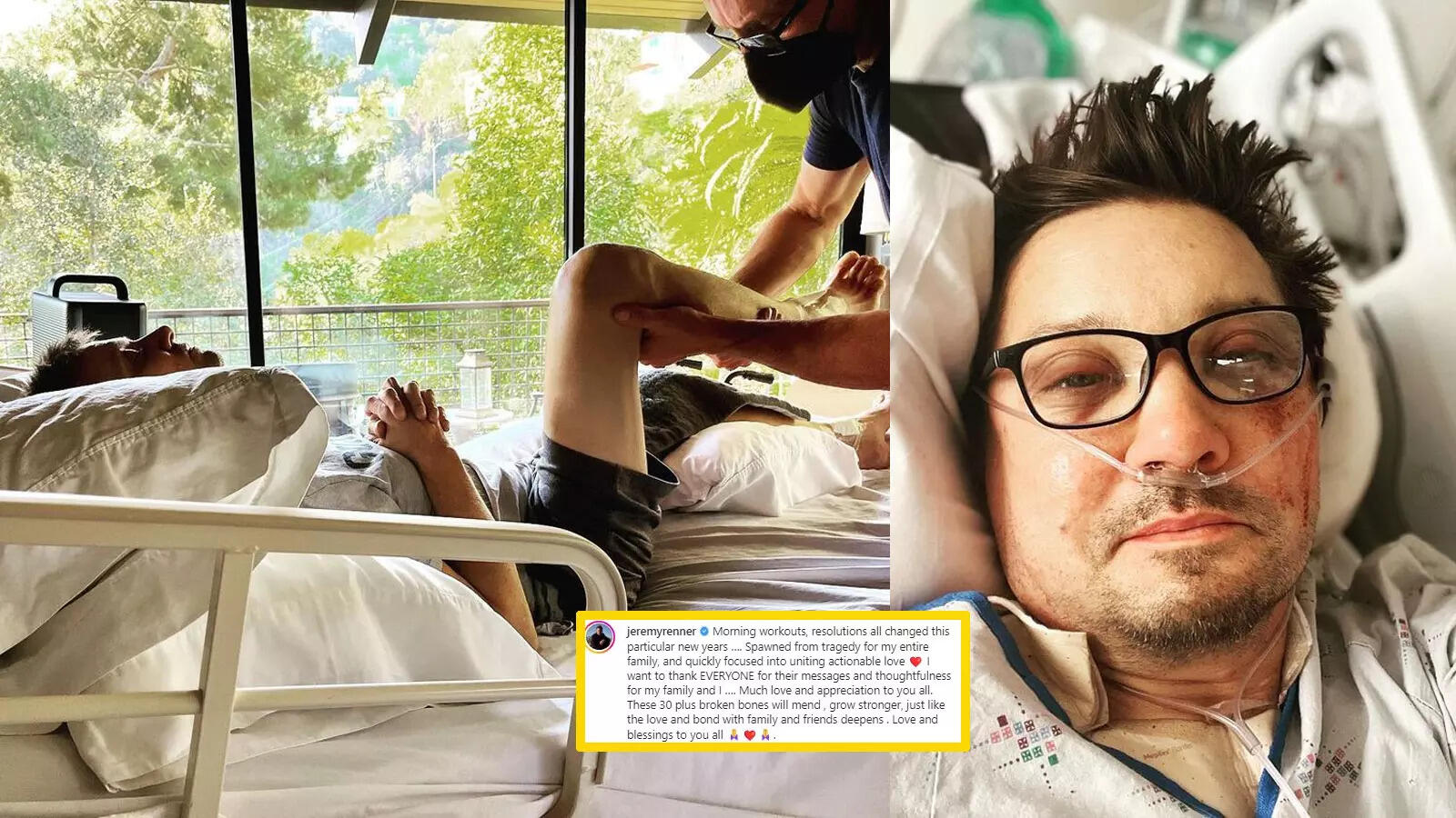 Jeremy Renner breaks over 30 bones in snow ploughing accident; Chris ...