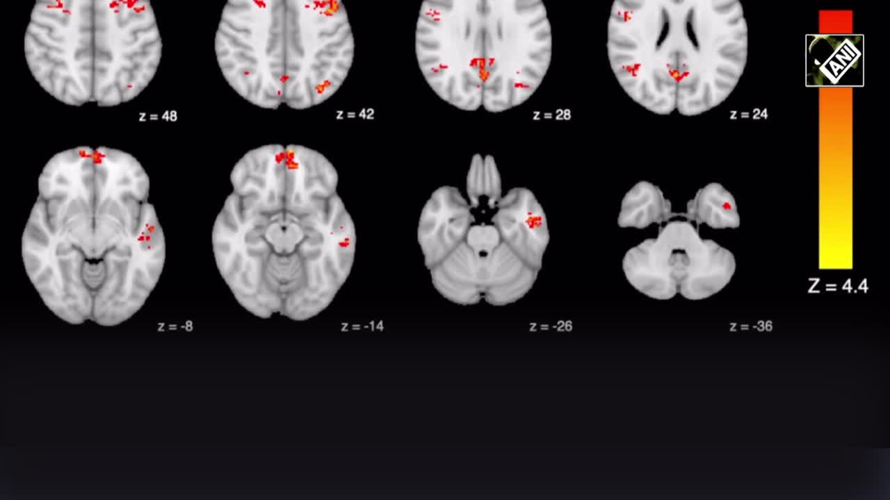 Traffic pollution affects brain function: Study