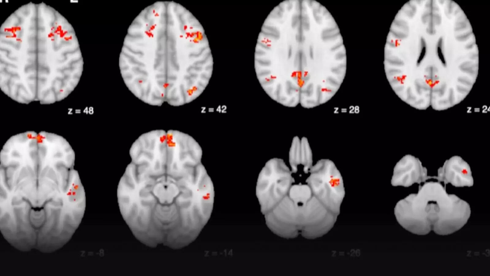 Traffic pollution affects brain function: Study