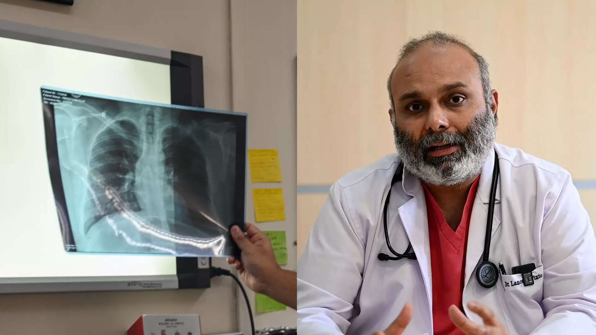 What pulmonologist Dr Lancelot Pinto advises