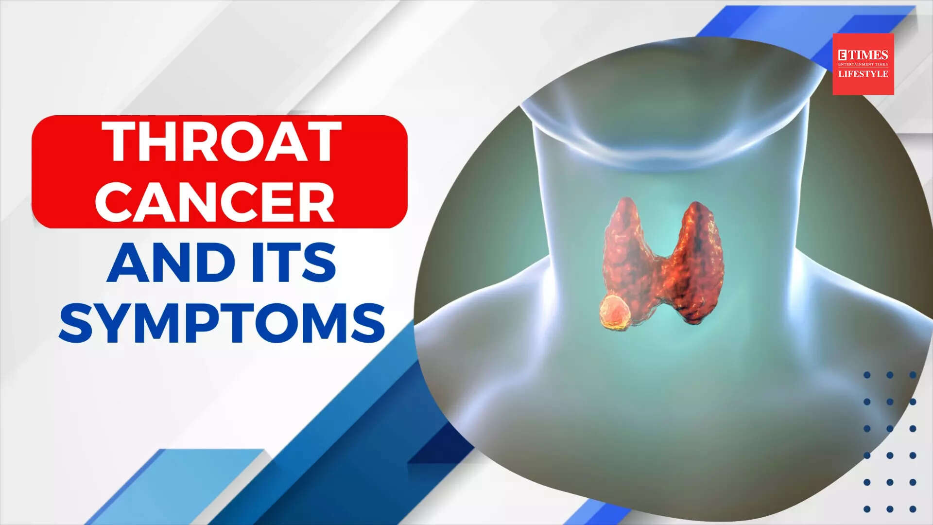Throat Cancer and its symptoms