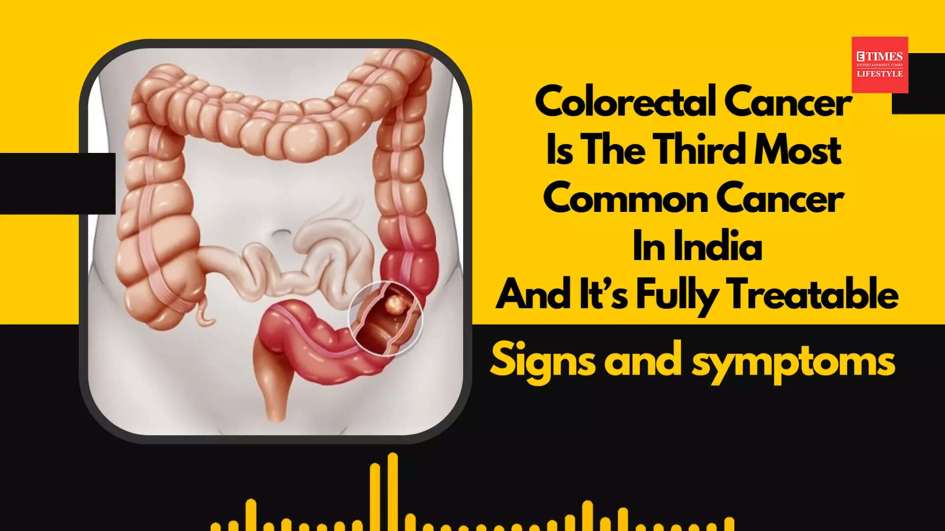 Colorectal cancer is the third most common cancer in India and it’s ...