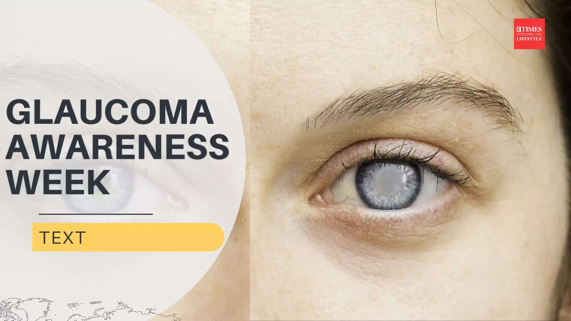 Glaucoma: Causes and symptoms of this blindness causing disease
