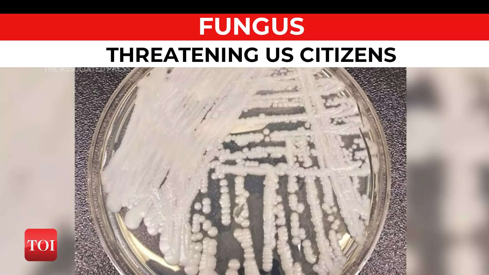 US Superbug fungus cases rose dramatically during pandemic