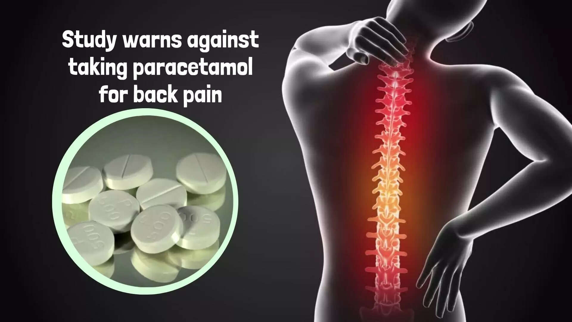 Study warns against taking paracetamol for back pain