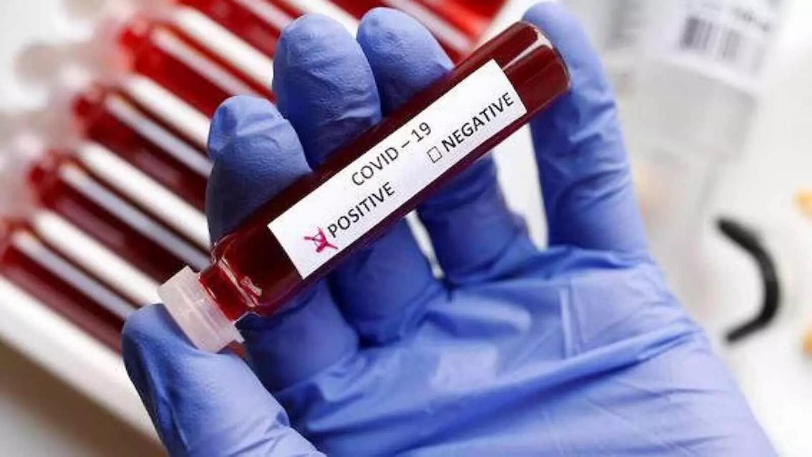 “New variant of COVID is not in severe form…” says pulmonologist: Dr ...