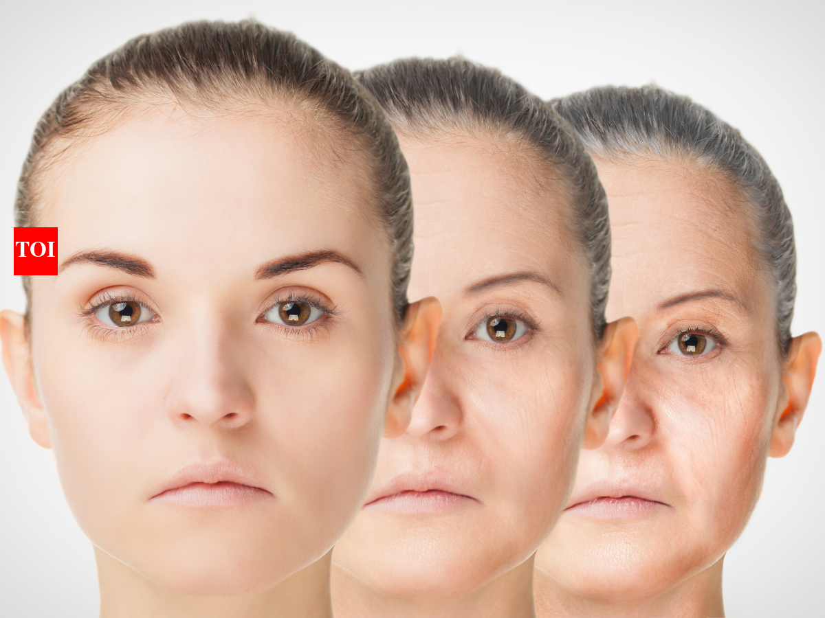 werner syndrome defect