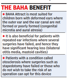 Hi-tech implant gives boy born with no left ear 100% cure | Bengaluru ...