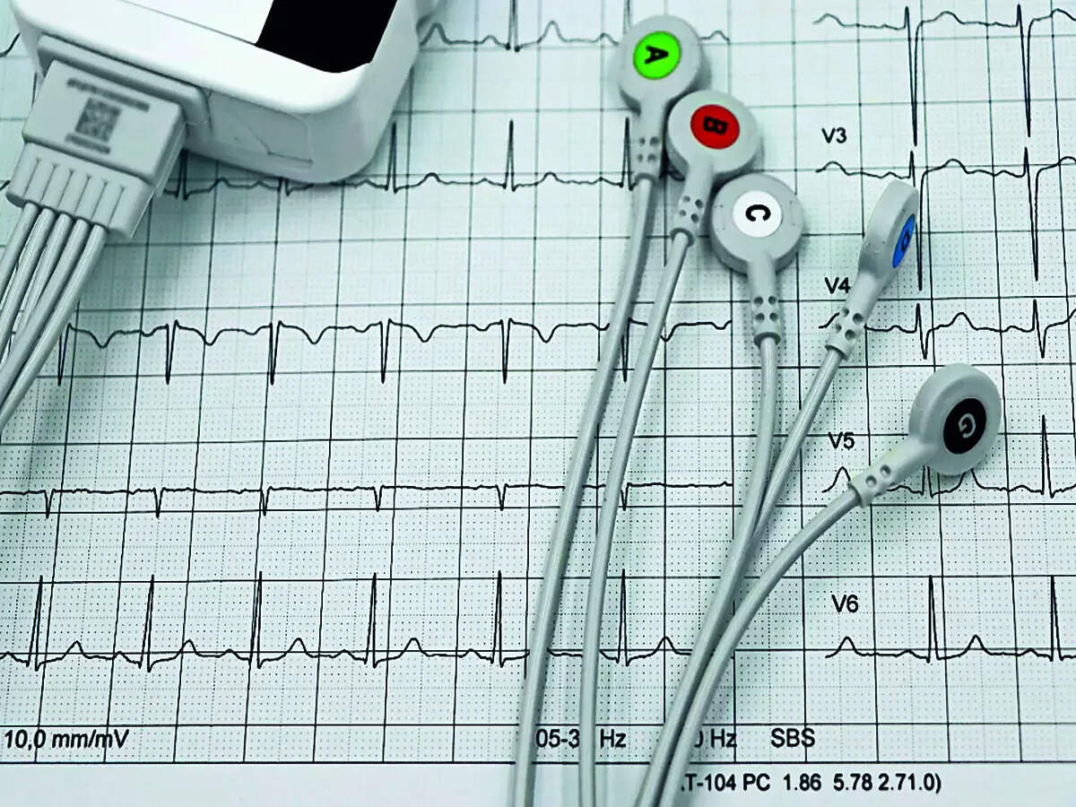 Heart attack death caught on CCTV