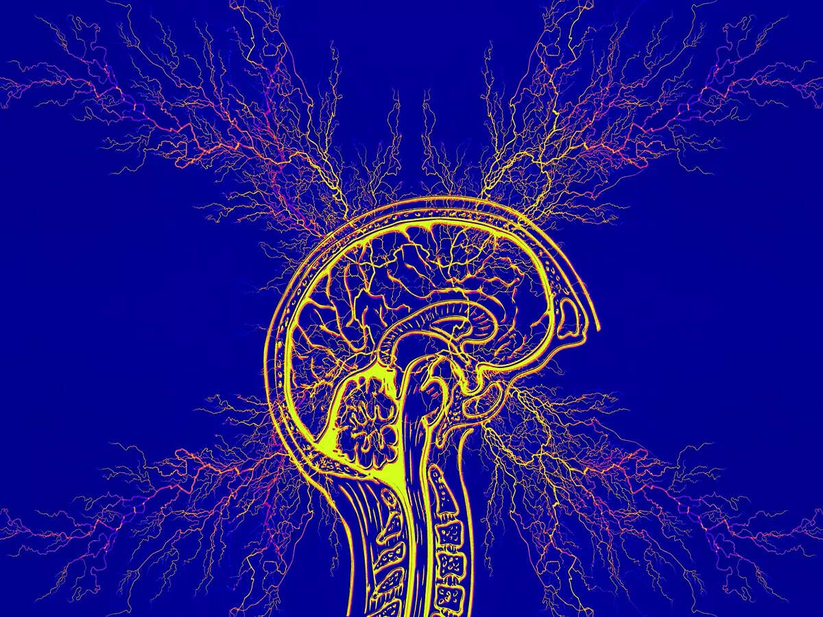 IISc team develops algorithm to detect seizures