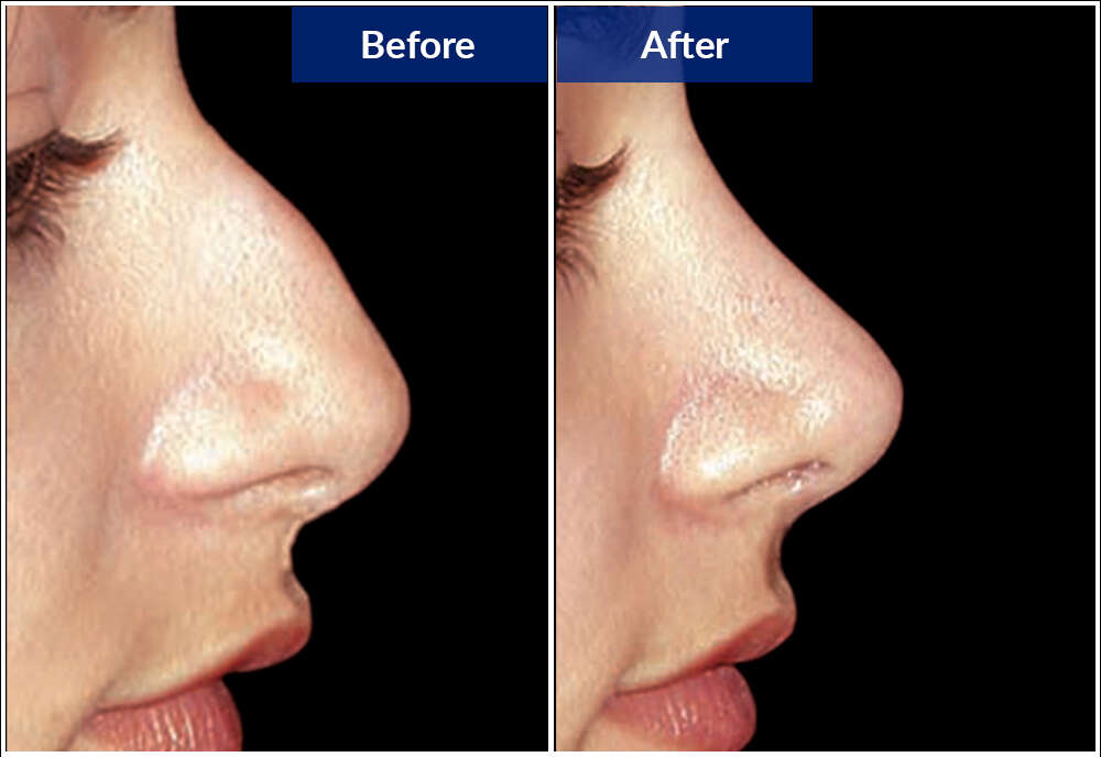 Craniofacial surgery for correction of complex craniofacial defects is ...