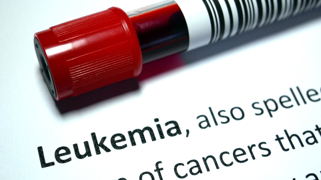 Childhood Leukemia: Causes, symptoms, and treatment of blood cancer ...