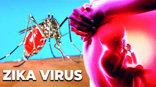 Decoding Zika virus: Symptoms, precautions, expert advice, all you need to know about Zika virus ...