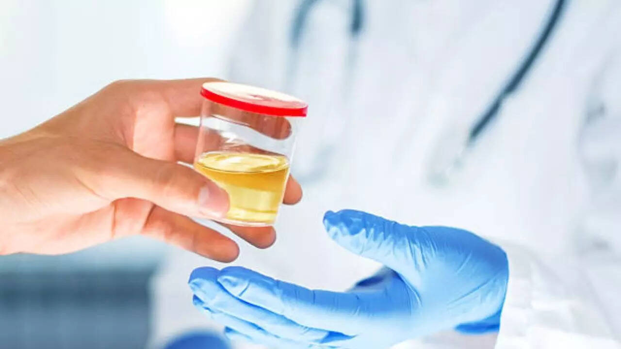 'Morning pee has stem cells': Wellness influencer's bizarre urine ...