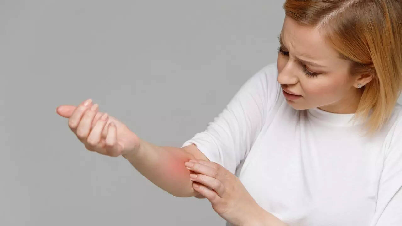 Robbie Williams reveals diagnosis of ‘17th-century pirate disease ...