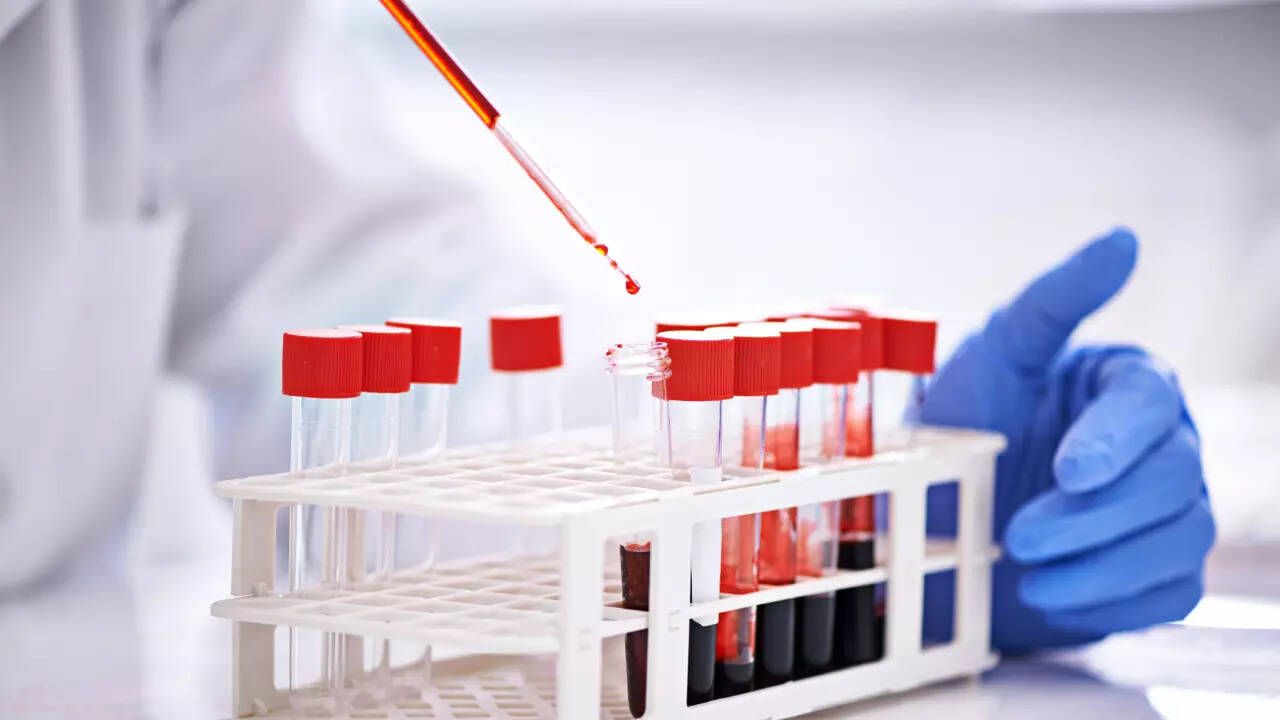 7 blood tests that can detect cancer in men and women | - Times of India
