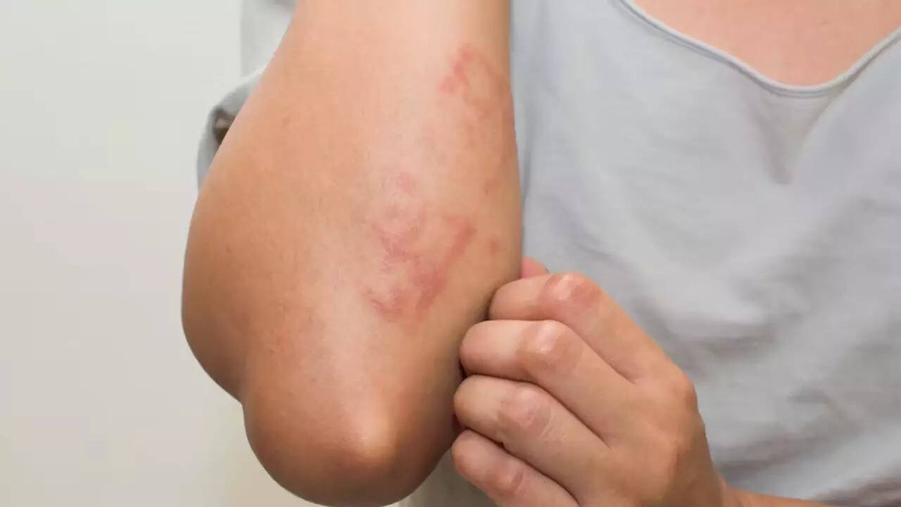 Fatty Liver Symptoms: 4 ways fatty liver disease can show up on your ...