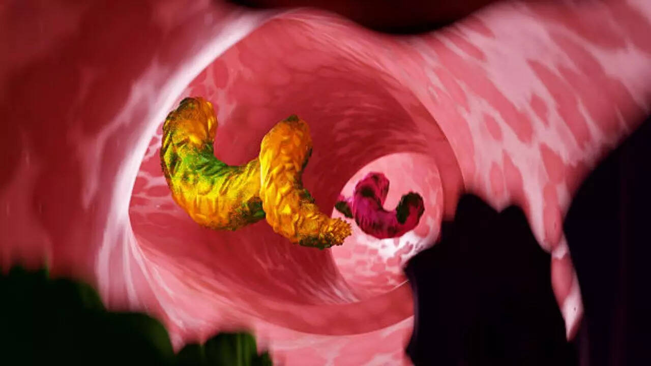 Intestinal Parasites Symptoms: Do you have intestinal parasites ...