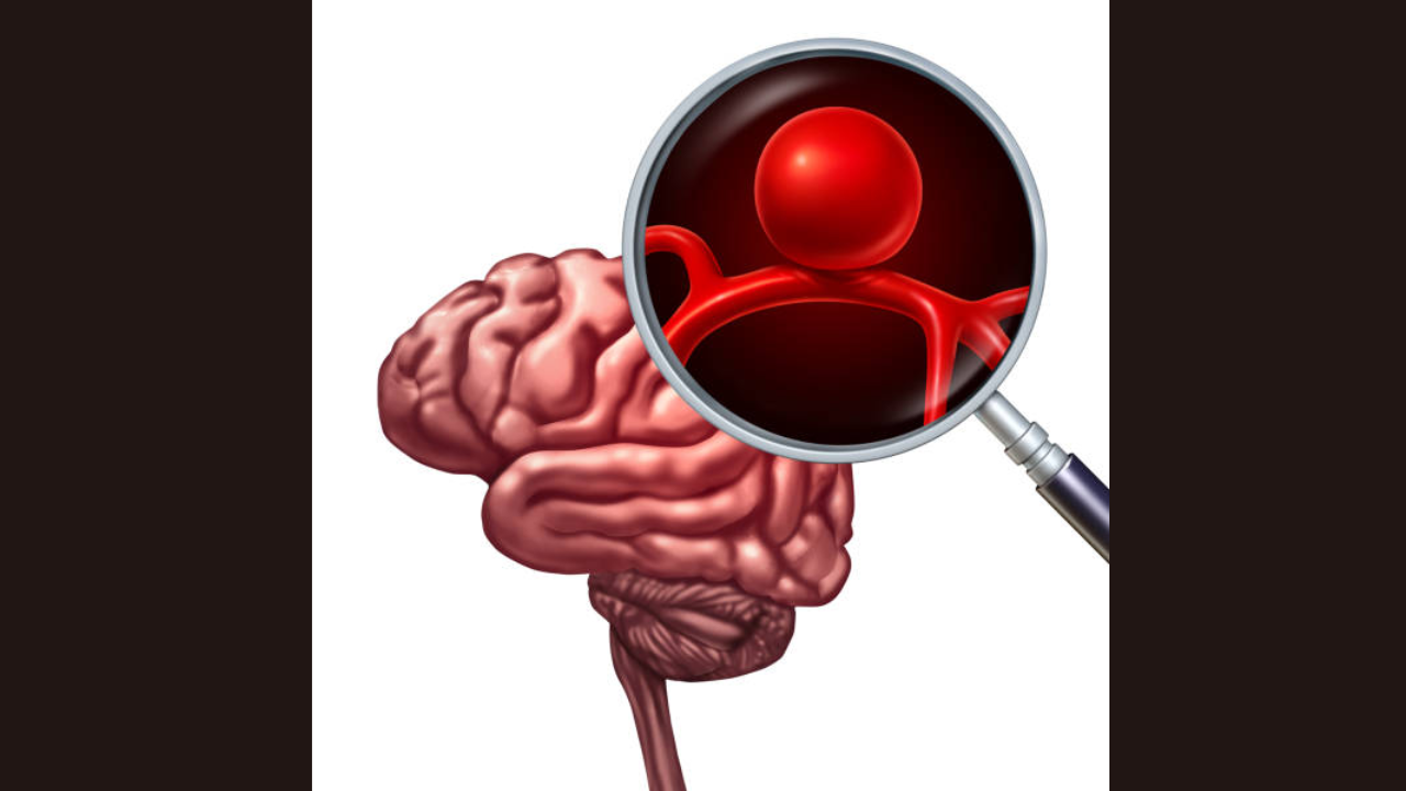 “I felt numb on one side”: Doctor explains how sudden numbness can ...