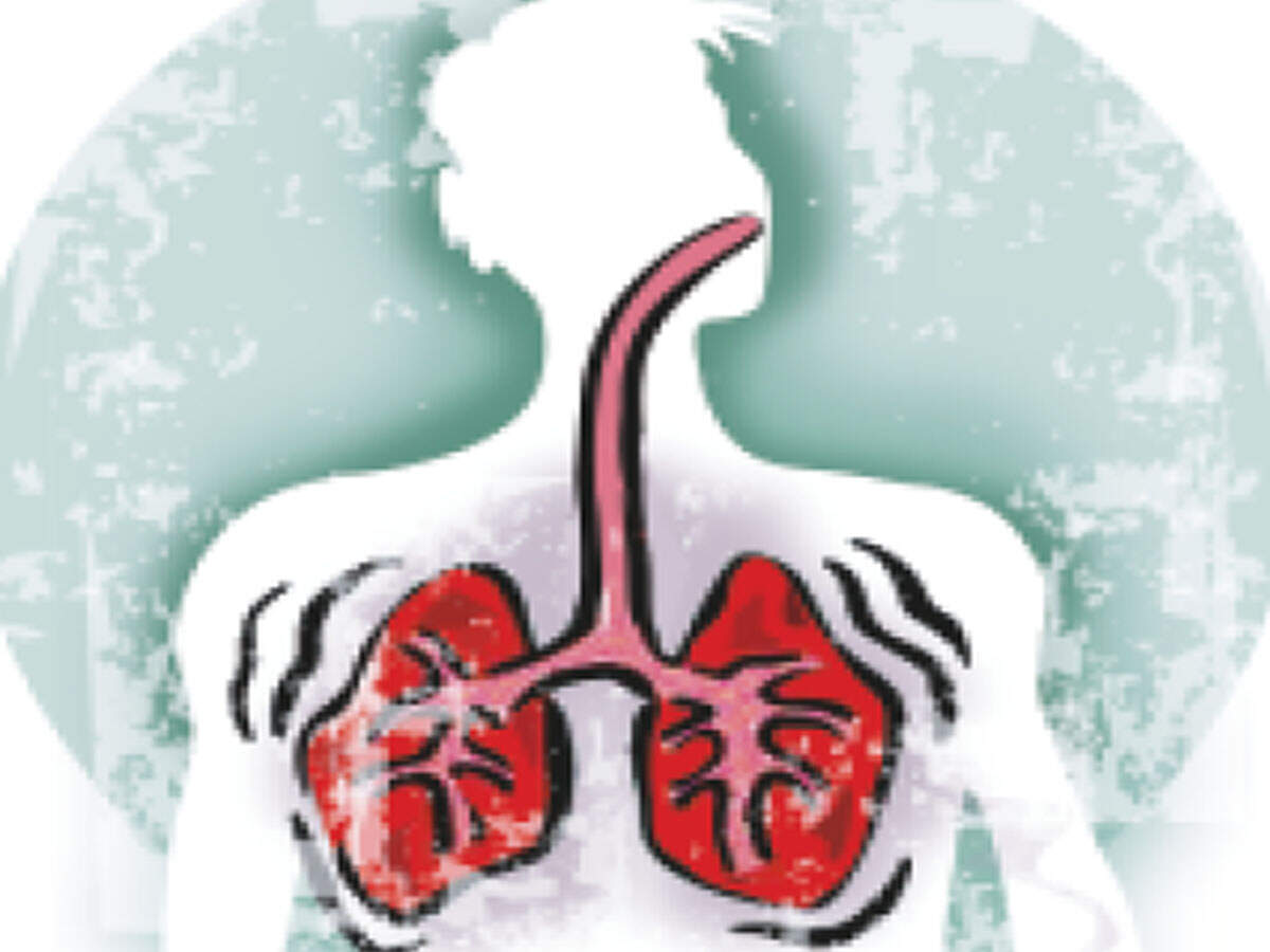 Acute infection could trigger chronic lung illness among recovered patients
