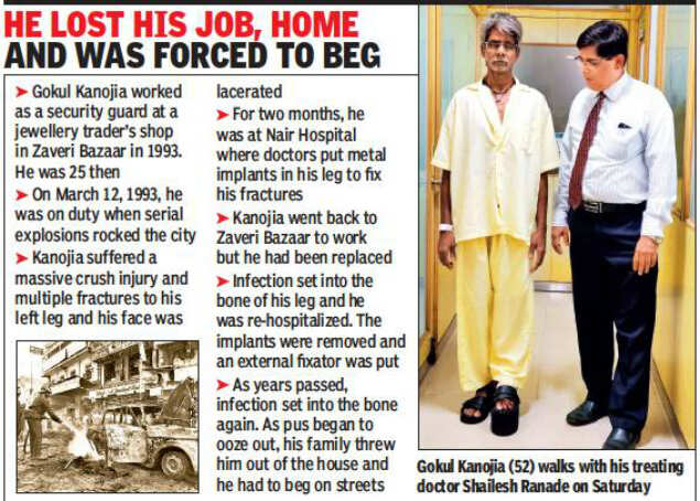 27 years on, festering leg wound of 1993 Mumbai blast victim heals ...
