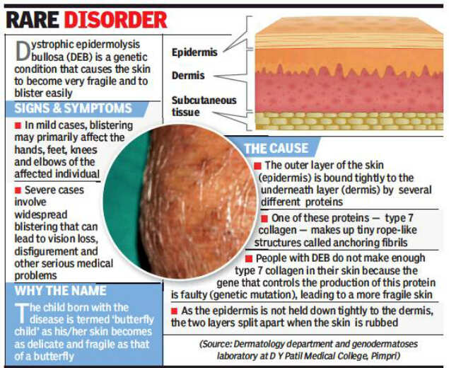 Six-year-old Chikhali boy with ‘butterfly skin’ stuns doctors | Pune ...