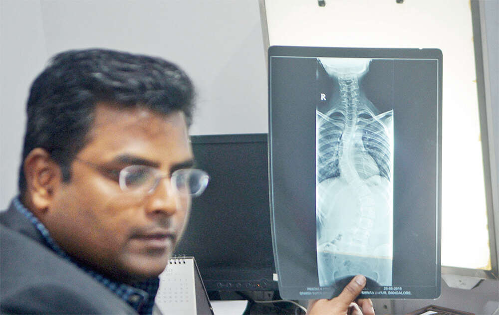 Scoliosis Treatment: Screws fix S-shaped spine