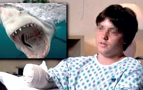 Fake news buster: Activist Got his Arm Bitten Off After Hugging a great ...