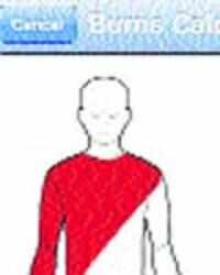 Burns app could save lives at the touch of a button