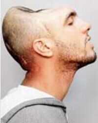 Mr Half-a-Head : A crook named so for obvious reasons