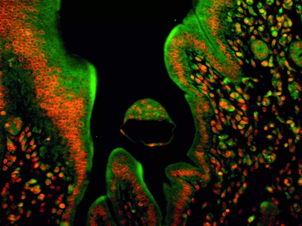 Mirrorlights: Researchers find genetic switch that allows uterus to ...