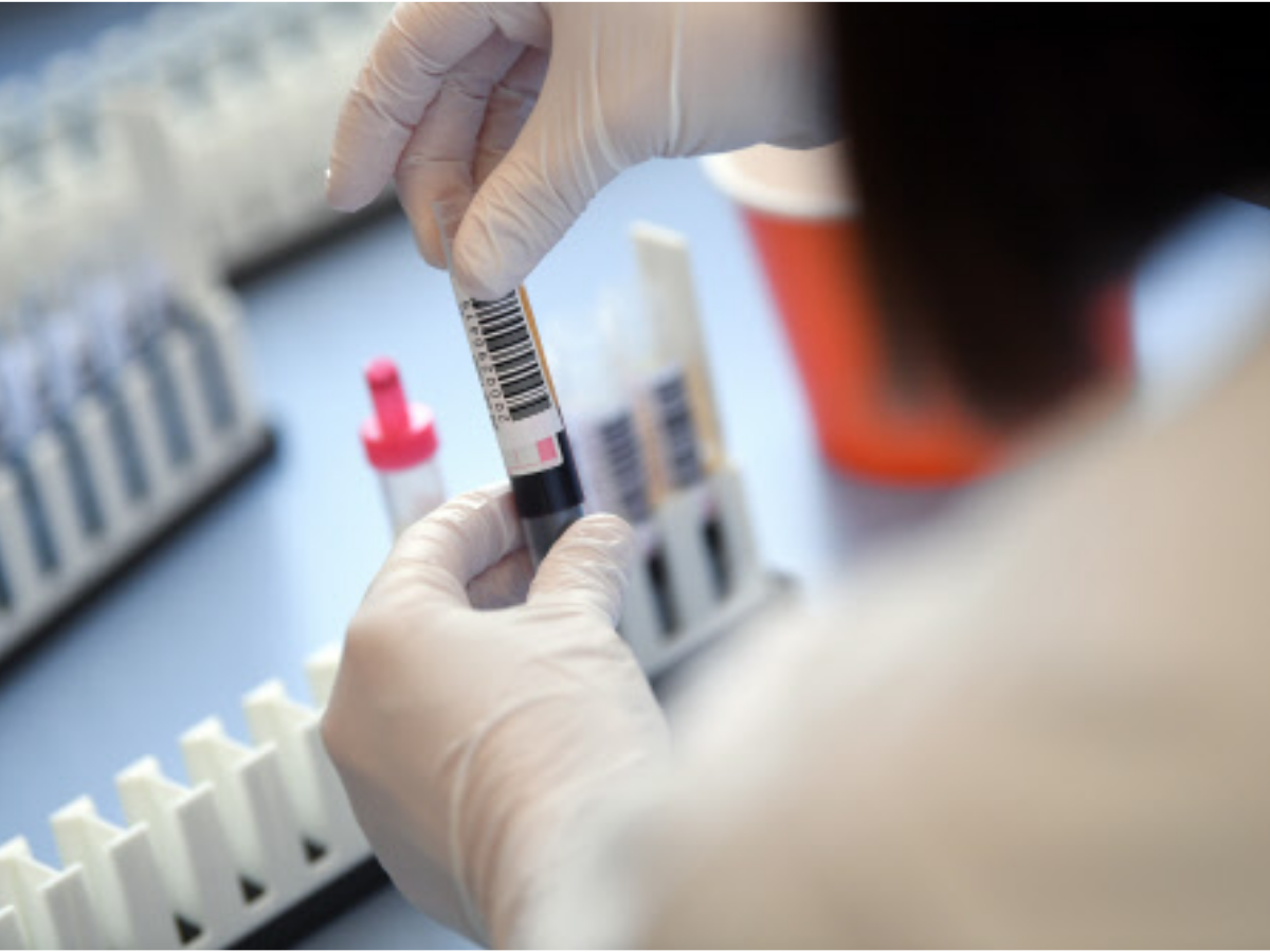 Health Ministry issues guidelines for RT-PCR pool testing for COVID-19