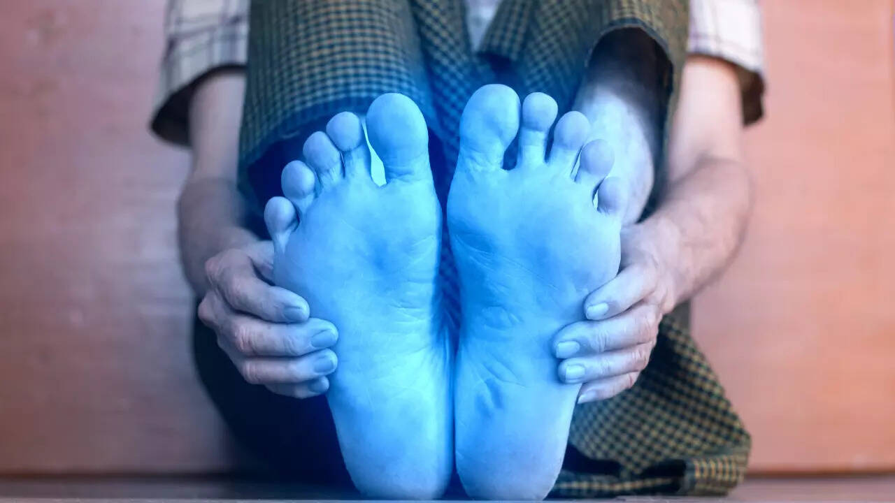 Health Warning Signs In The Feet: 5 health warning signs in the feet ...