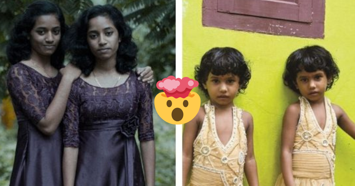 This Indian village has over 400 pairs of twins | Times of India