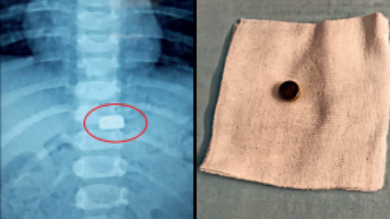 Sector 35, Noida: Map, Property Rates, Projects, Photos, Reviews, Info