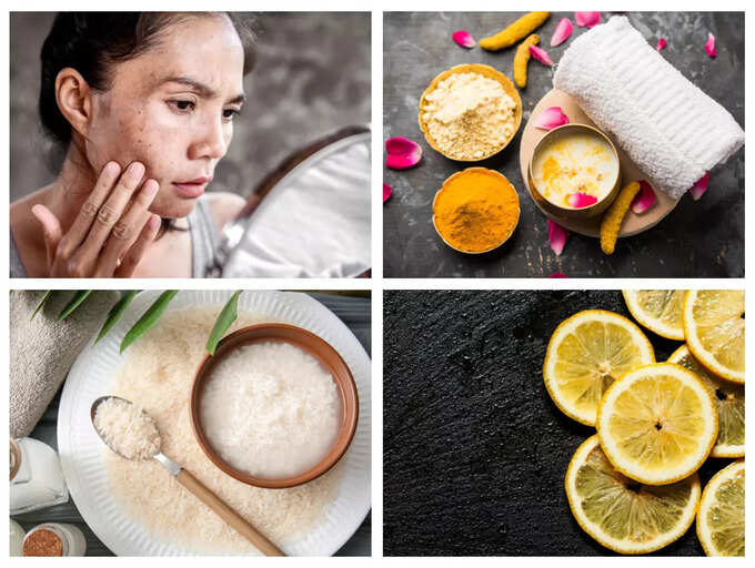 Proven kitchen remedies for dark spots | The Times of India