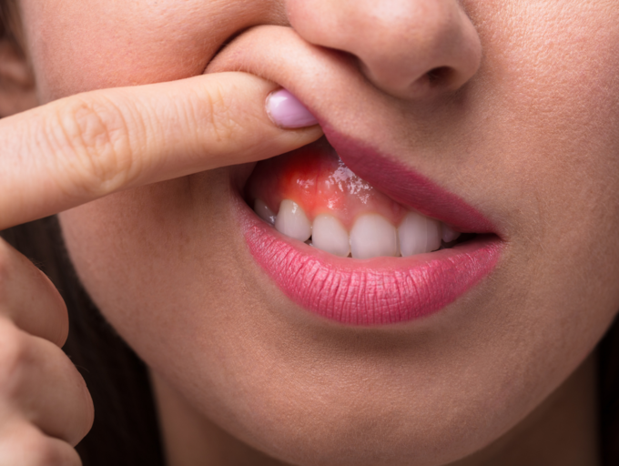 Gum care at home: 8 essential tips to tighten your gums | The Times of ...