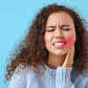Home Remedies For Toothache: Simple way to fix toothache with kitchen ...