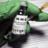 Early Symptoms Of Mumps: Swelling on the face could be mumps; early ...