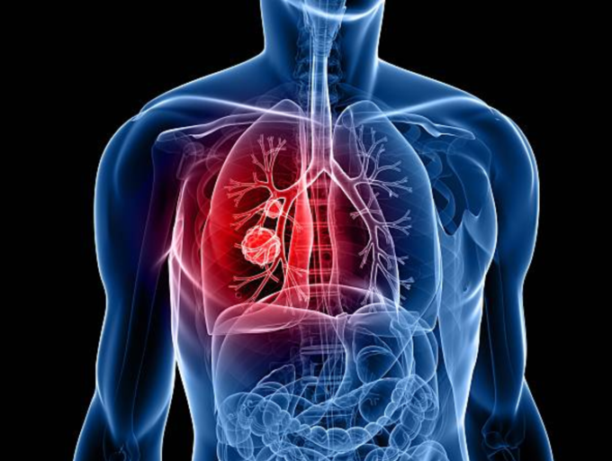Ever heard of popcorn lung? Know what it is and why it happens? | The ...