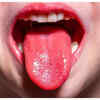 5 warning health signs that the tongue reveals!